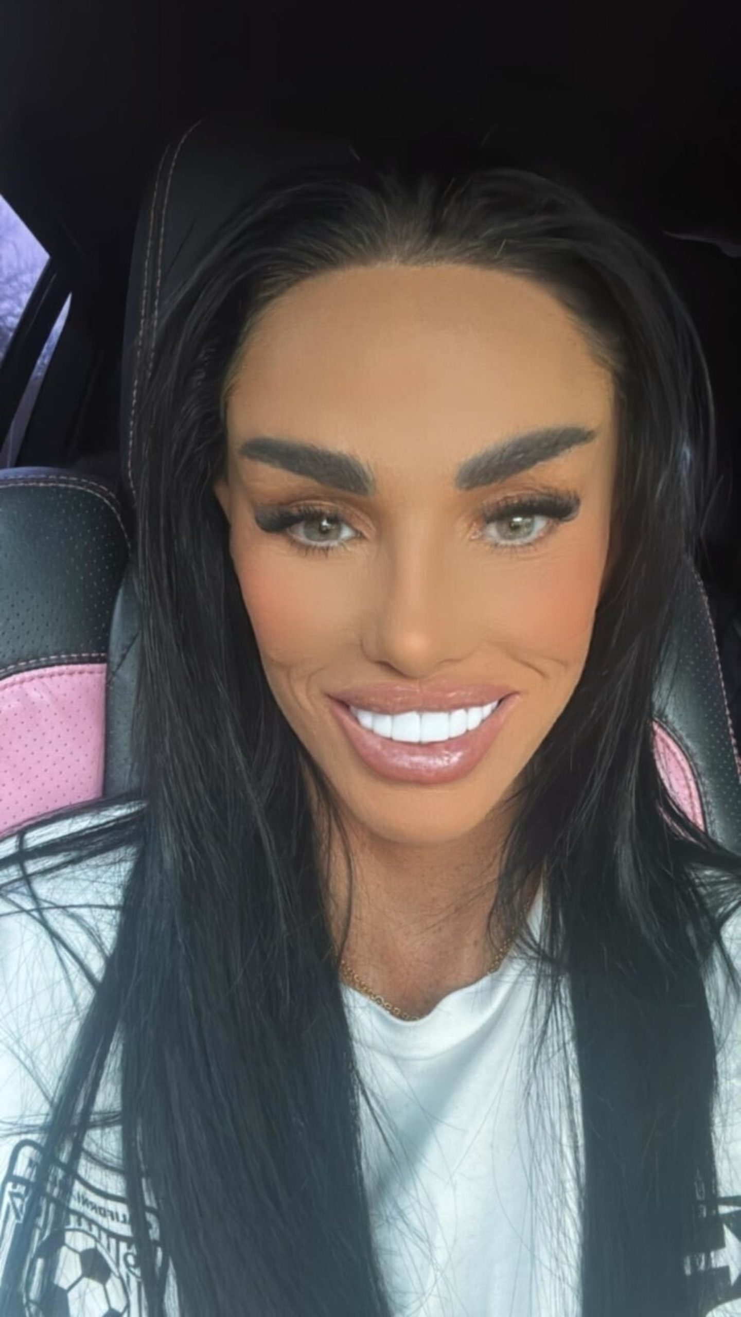 Katie Price: A Journey Through Fame, Challenges, and Resilience ...
