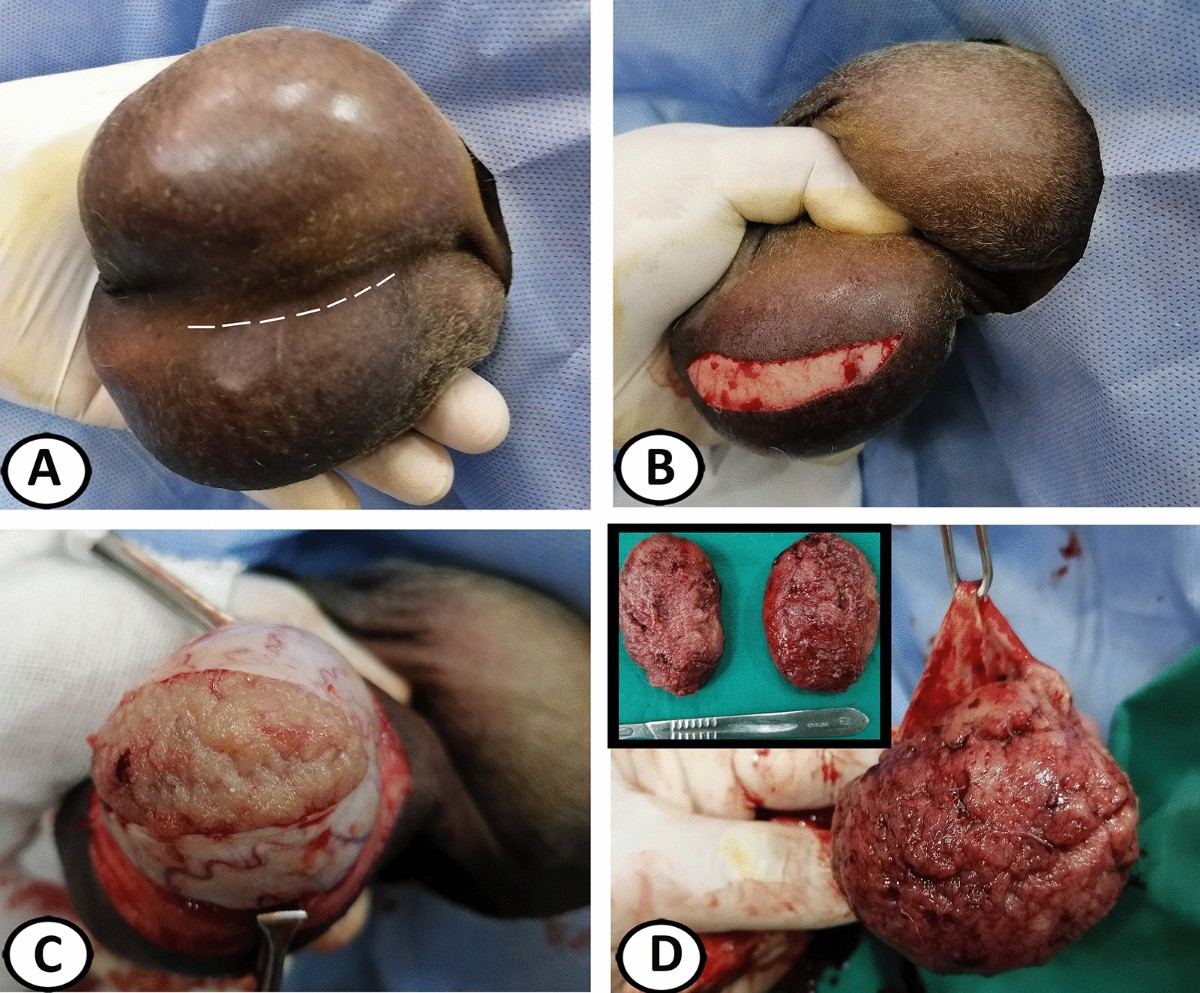 An Insight into Chemical Castration: Implications and Uses – Invisiverse News