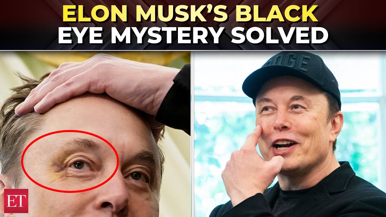 The Curious Case of Elon Musk’s Black Eye – Invisiverse News