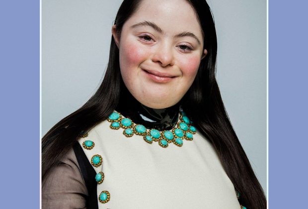 Ellie Goldstein: A New Era in Fashion Inclusivity – Invisiverse News