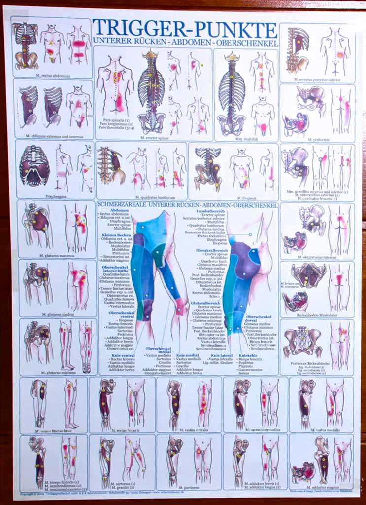 Exploring Trigger Points and Their Impact on Muscular Health ...